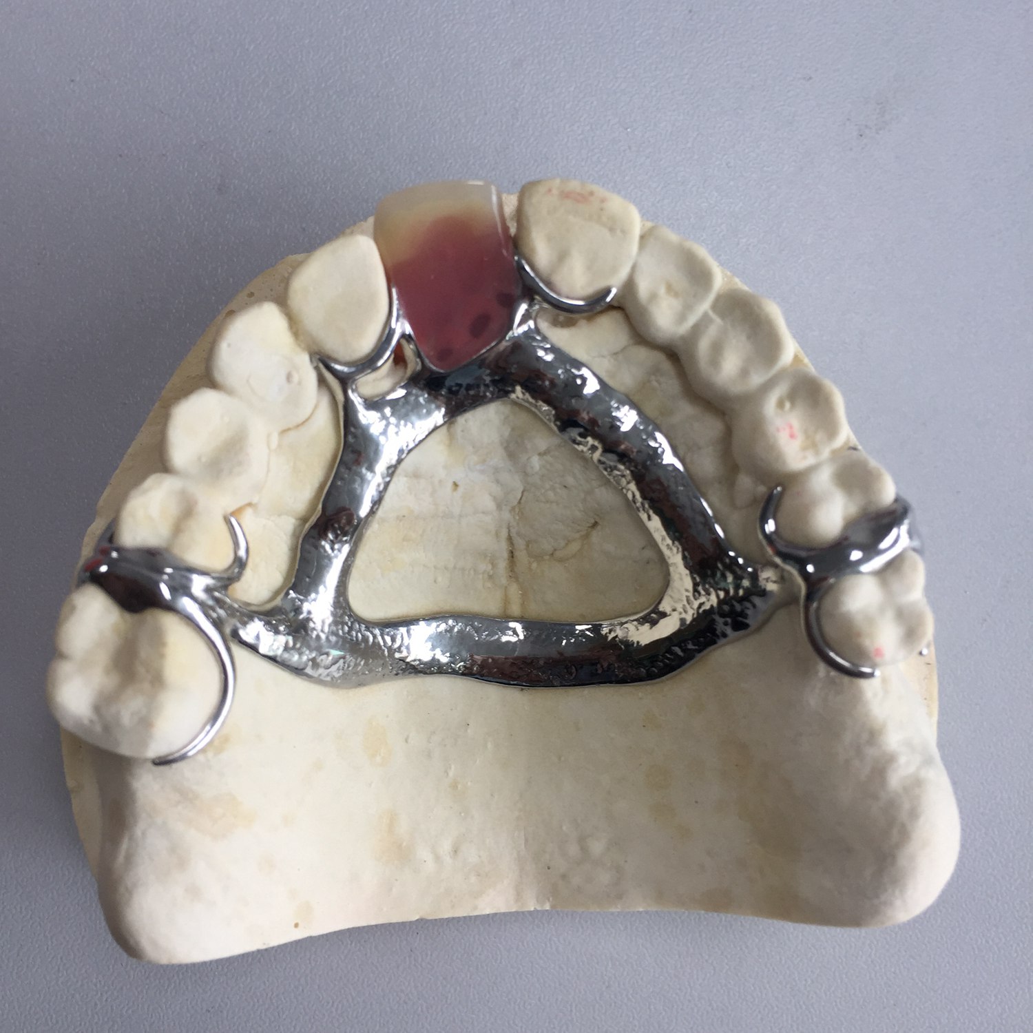 Shenzhen new dimension dental Co., LTD